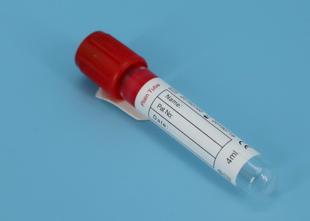 Disposable Serum Blood Collection Tube For Medical Laboratory
